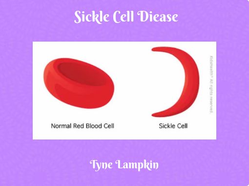 "Sickle Cell Diease" - Free stories online. Create books for kids ...